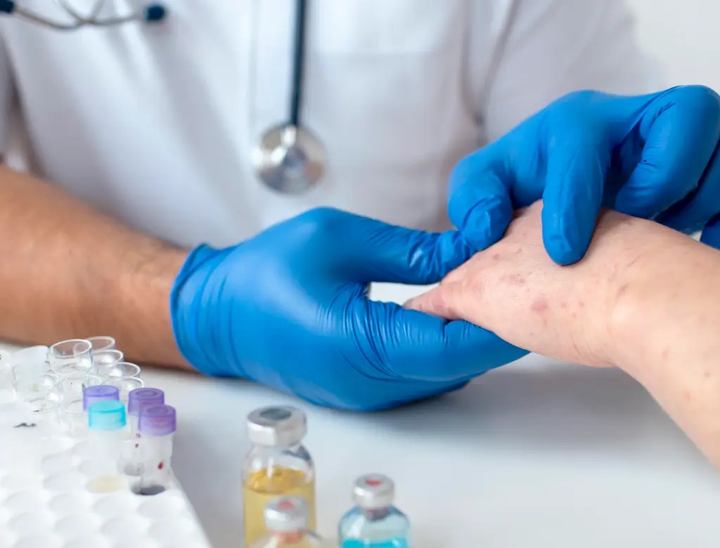 Nova variante da mpox é detectada em dois países e preocupa OMS; saiba ...